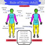 Rule of Nines for EMS - EMT Training Base